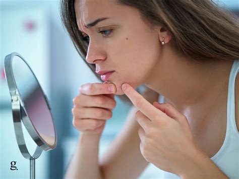 The Lowdown On Blind Pimples 4 Practical Tips For Tackling Them Glooshi