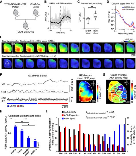 Regional Variation In Cholinergic Terminal Activity Determines The Non Uniform Occurrence Of