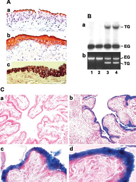 Uroplakin Ii Semantic Scholar