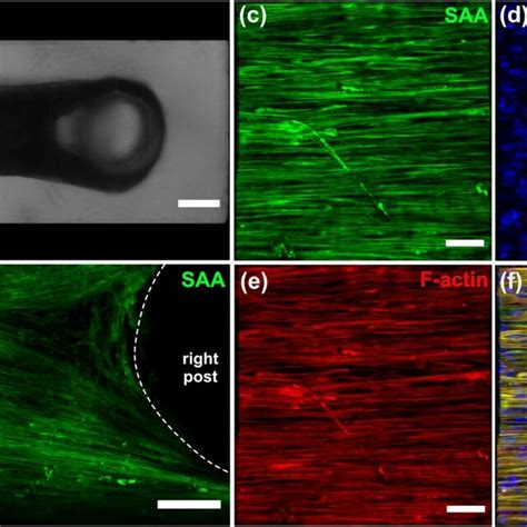 Bioengineered In Vitro 3d Human Skeletal Muscle Tissue In A Xeno Free