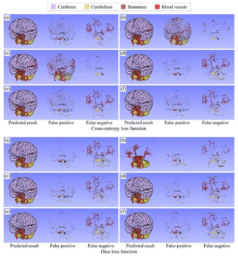 Visualization Of The Segmentation Results In The Five Class Download Scientific Diagram