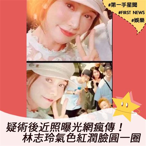 第一手星聞 看到志玲姊姊的近照，還是一樣的健康美麗～（燒編） 疑術後近照曝光網瘋傳！林志玲氣色紅潤臉圓一圈