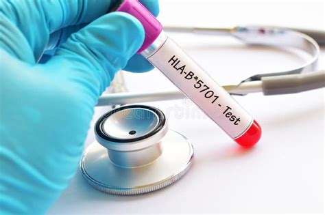 Blood Sample For HLA B Test Stock Image Image Of Gene Antiretroviral