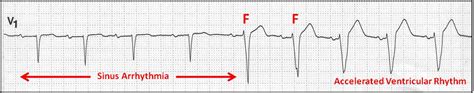 Ecg Learning Center An Introduction To Clinical Electrocardiography