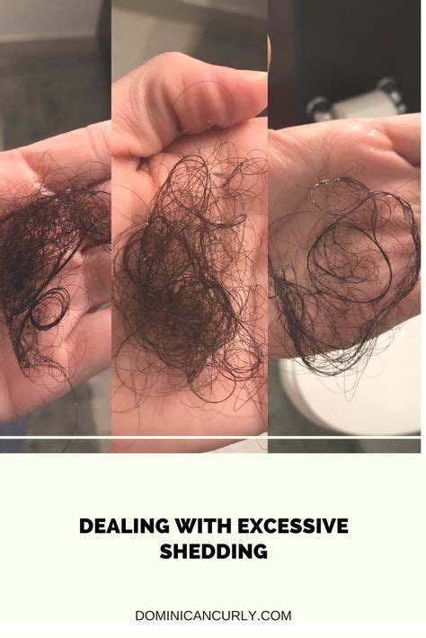 Dealing With Excessive Shedding Diy Hair Care Excess Hair Hair Care