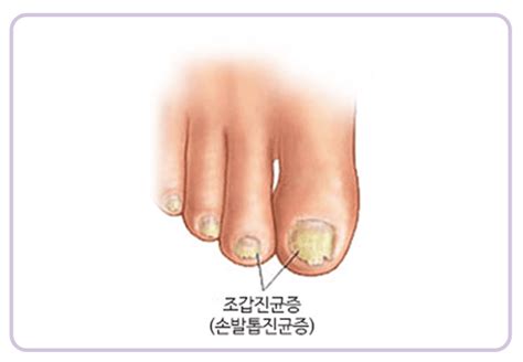 성범진피부과 의원