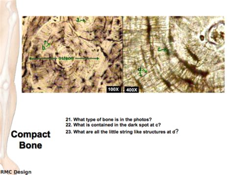 Compact Bone Microscope Image Paper Practical R Chute Aandp 1