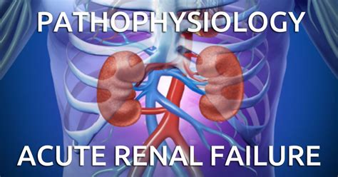 Pathophysiology Of Acute Renal Failure Schematic Diagram Acu