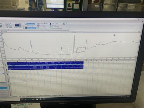 Why Has My Baseline Gone From A Relatively Flat Line To This Koh Ecg