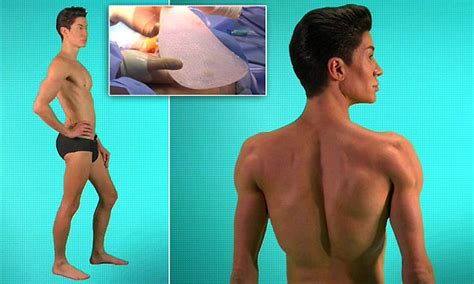 Justin Jedlica Before And After Telegraph
