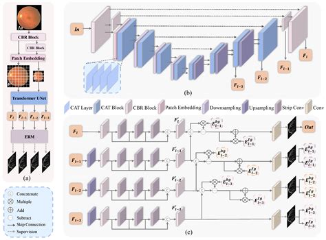 Exploiting Cross Scale Attention Transformer And Progressive Edge Refinement For Retinal Vessel
