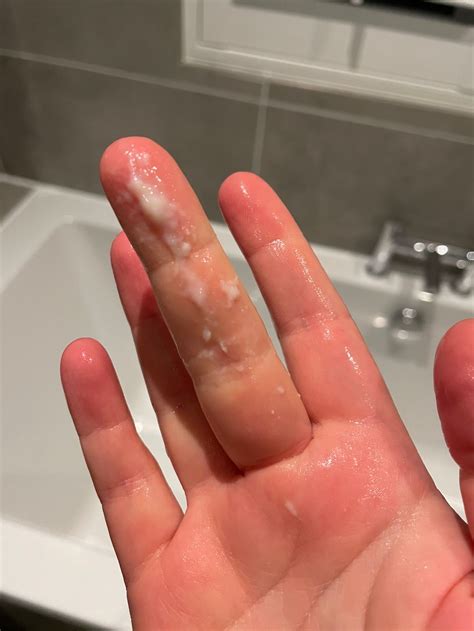 Creamy Cervical Mucus