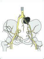 Interventional Radiology Coding Cardiology Coding Medical Coding Resources