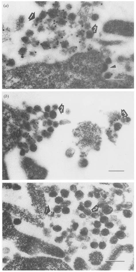Immunolabeuing Of Wild Type And Mutant Forms Of Vpr On Hiv1 Virions