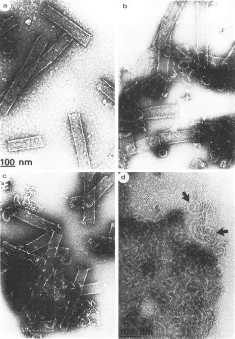 Electron Micrographs Of Baculovirus Expressed Mutant Ns1 Tubules A