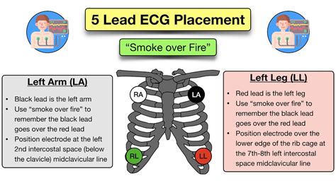 12 Lead Ecg Placement Mnemonic