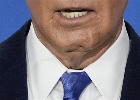 Whats Up With His Chin Viewers Ask After Spotting Odd Detail During