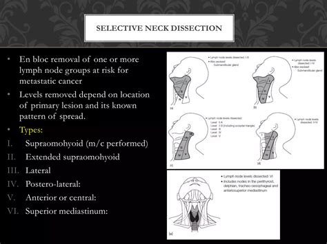 Neck Dissection Pptx
