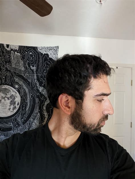 Diffuse Thinning Over The Past Couple Years Any Advice Or How Do You Guys Think I Would Look