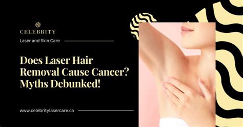 Does Laser Hair Removal Cause Cancer Myths Debunked Celebrity Laser