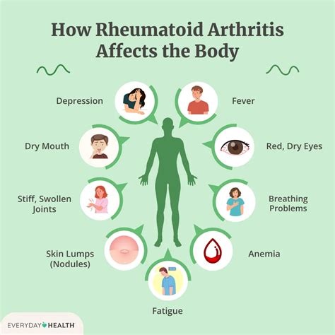 Arthritis Causes Swelling
