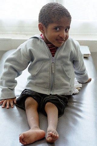 Polio Images