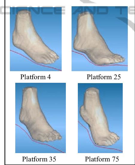 Deformation And Inclined Platform Adjustment Of The Foot 1 In Figure