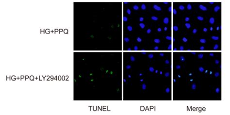 Ly294002 Pi3k Inhibitor Medchemexpress