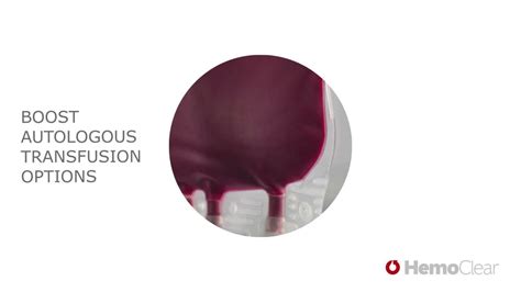 [video] Willem Van Prooijen Mpm Posted On Linkedin