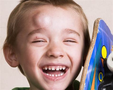 ¿qué Hacemos Si Al Niño Le Sale Un Chichón Pizquito