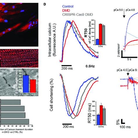 Human Induced Pluripotent Stem Cell Derived Cardiomyocytes A