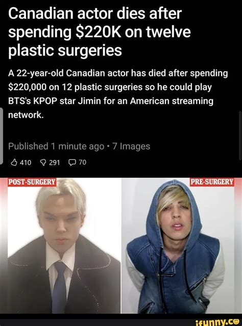 Canadian Actor Dies After Spending 220k On Twelve Plastic Surgeries 22