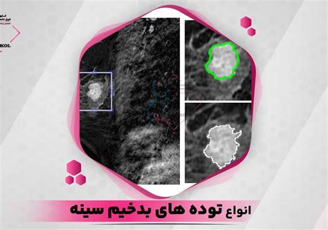 مقالات وبسایت رسمی دکتر مهسا توکل متخصص جراحی عمومی و فلوشیپ تخصصی