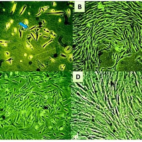 Microscopic Follow Up For Morphological Characteristics And