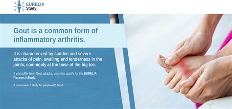 Gout Orlando Fl Clinical Trial