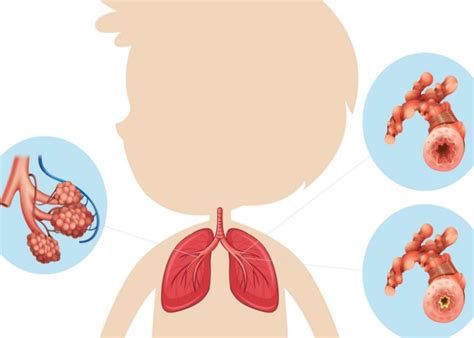 哮喘儿童体育课只能免上？如何运动？儿童医院专家权威解答