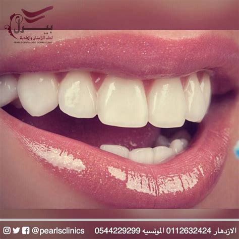 ارتبط مظهر الأسنان وبياضها بالجمال حتى أن الأسنان بلونها اللؤلؤيّ