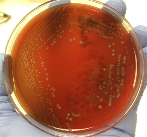 Enterococcus Faecalis On Bap Microbiology Medical Laboratory Science