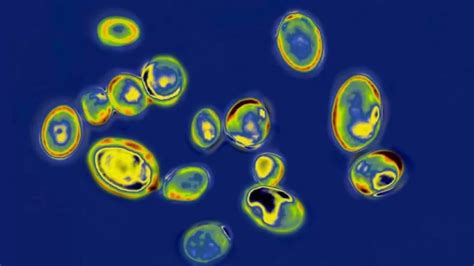 Candida Auris Fungal Infections Spreading In Us At ‘alarming Rate