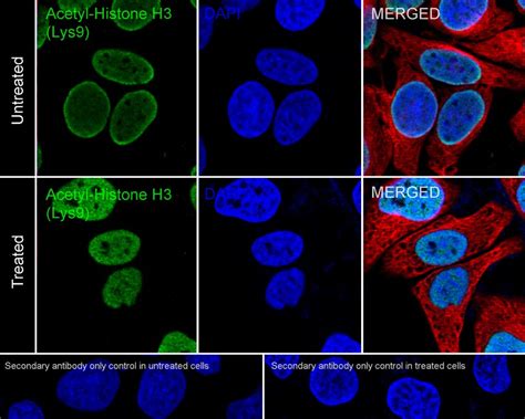 Acetyl Histone H3 K9 Recombinant Rabbit Monoclonal Antibody Psh04 4