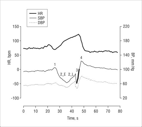 Example Of Heart Rate Hr Systolic Blood Pressure Sbp And