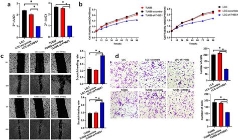 Thbs1 Promotes The Proliferation Migration And Invasion Of Laryngeal