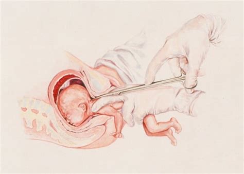 Exclusive Rick Santorum On Fighting For Life Politically And