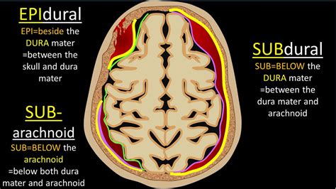 1 Radiologist Not Answering The Phonejust Want A Quick Read On That