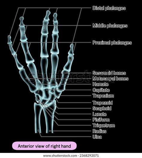 Xray Style Illustration Explanation Bones Persons Stock Illustration