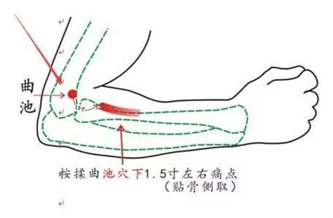 曲池的位置及功效 手三里 位置图 大山谷图库
