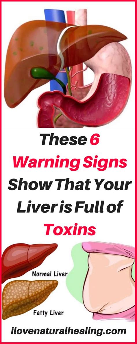 Signs That Your Liver Is Full Of Toxins Fitness Fiesta