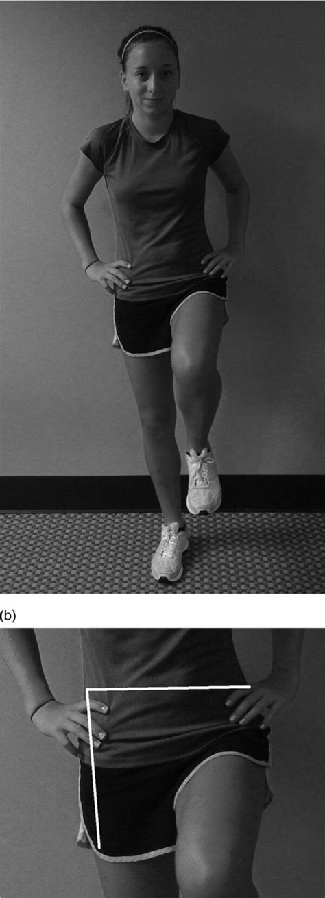Trendelenburg Test Wikism Sports Medicine Wiki