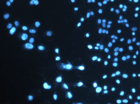 Mycoplasma Test With Hoechts 33342 Can Anyone Please Comment On My