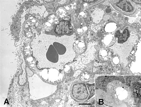 Figure 4 From Glomerular Calcification Induced By Bolus Injection With